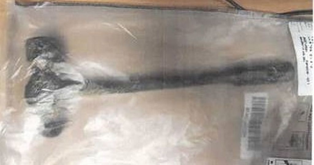Hammer attack accused claims he was set upon after…