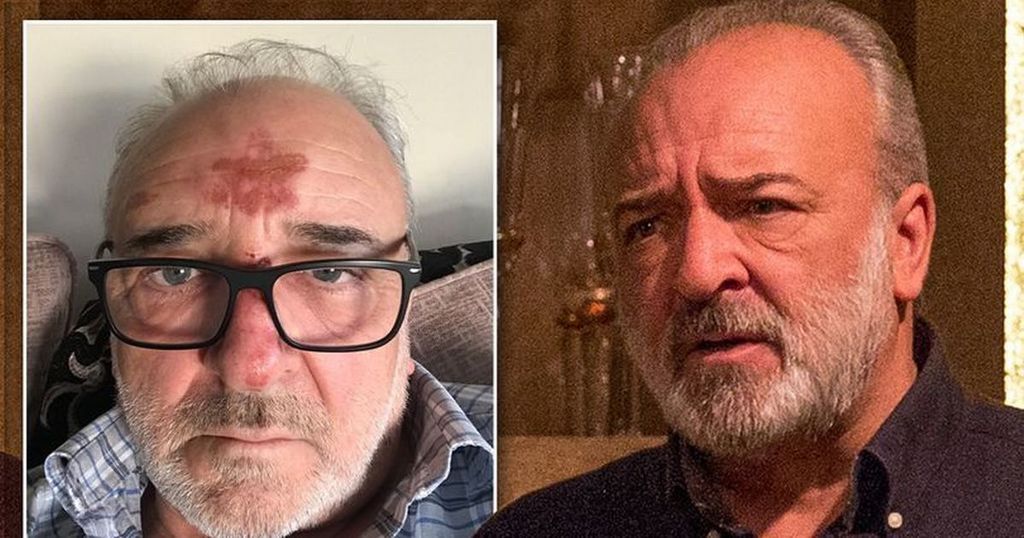 Ex Emmerdale star John Bowe shares shocking image of…