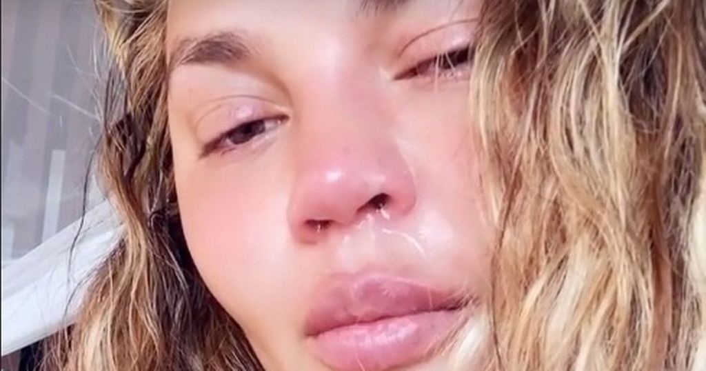 Chrissy Teigen films herself crying after therapy…
