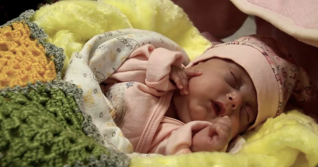 Tiny baby born prematurely at 23 weeks and weighing…