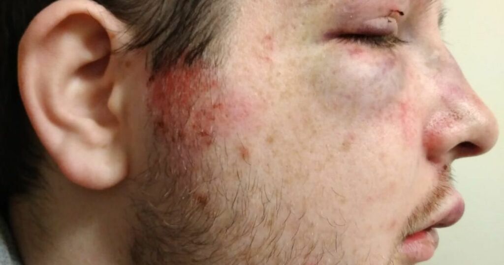 Autistic man left bleeding after stranger grabbed and…