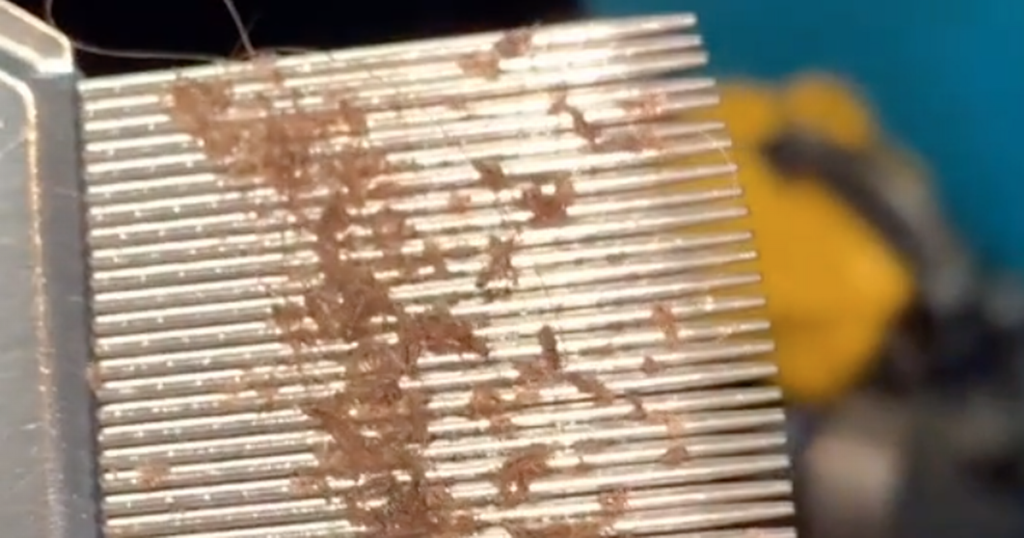 Skin-crawling moment mum discovers hundreds of head…