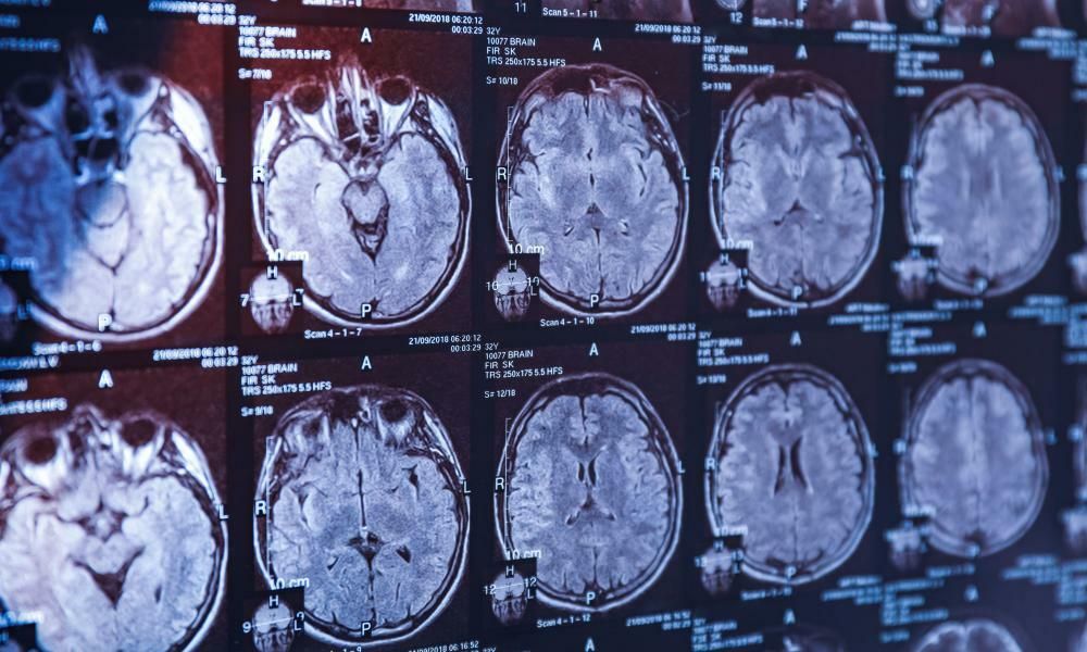 Scientists discover why the human brain is so big