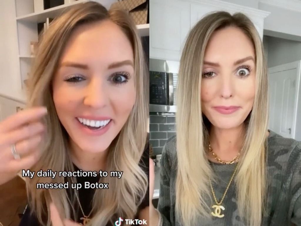 Influencer praised for honesty after documenting Botox…