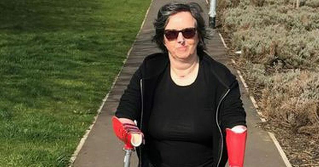 Mum with 5% survival chance after losing limbs to…
