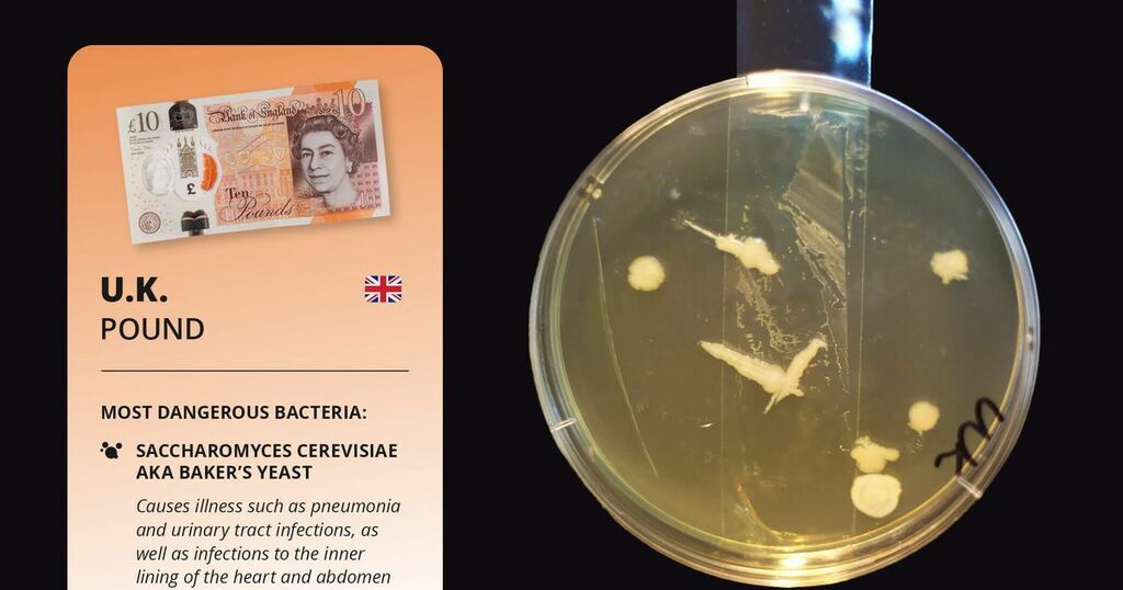Which bank notes carry the most dangerous bacteria