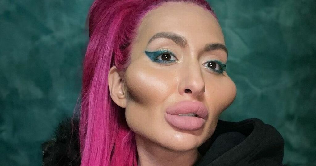 Woman with ‘world’s biggest cheeks’ plans more surgery…