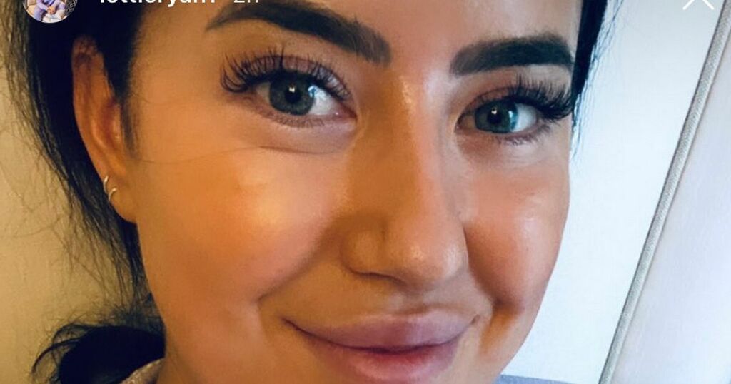 RTE's Lottie Ryan breaks silence on ‘rollercoaster…