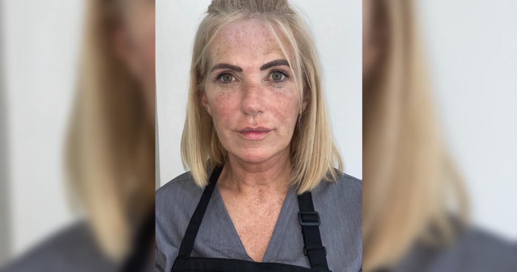What is a 'Formby Facelift' and why is it called that?