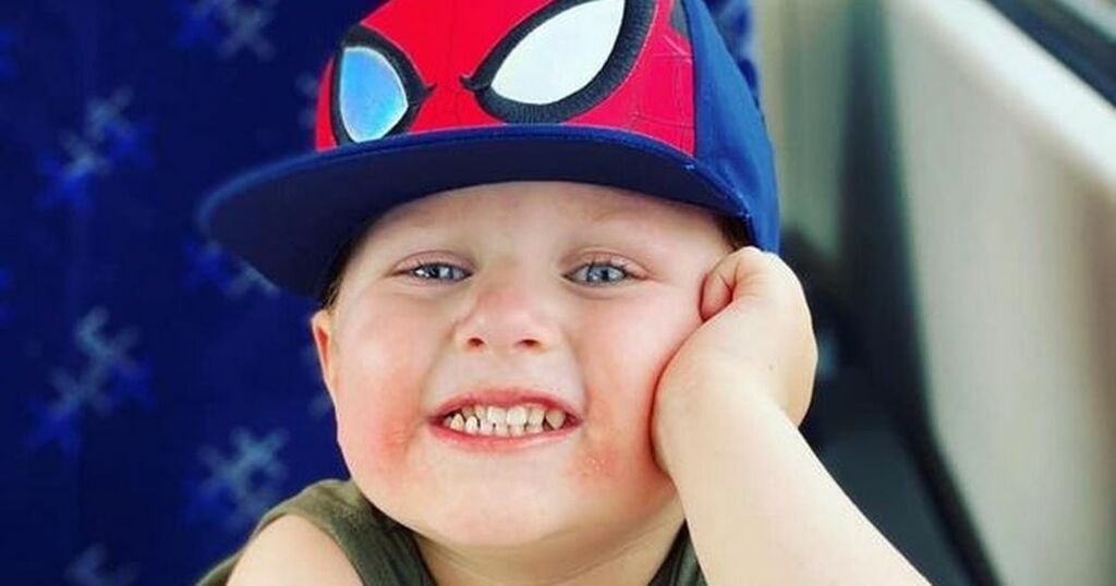 Scots boy born with one arm says ‘I’m not strange’…