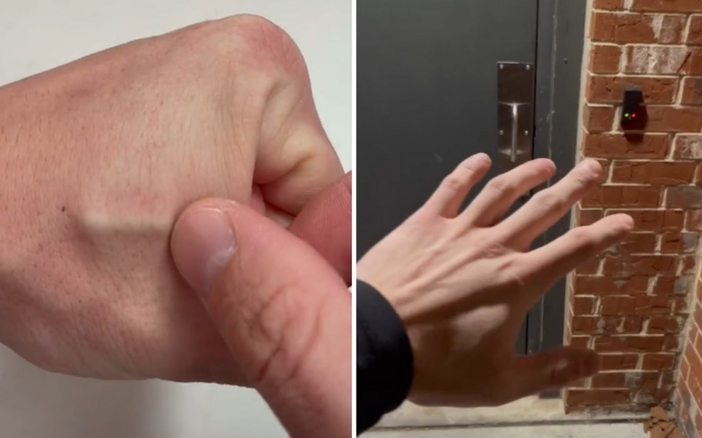 TikTok ‘biohacker’ shows how chip implant makes life…
