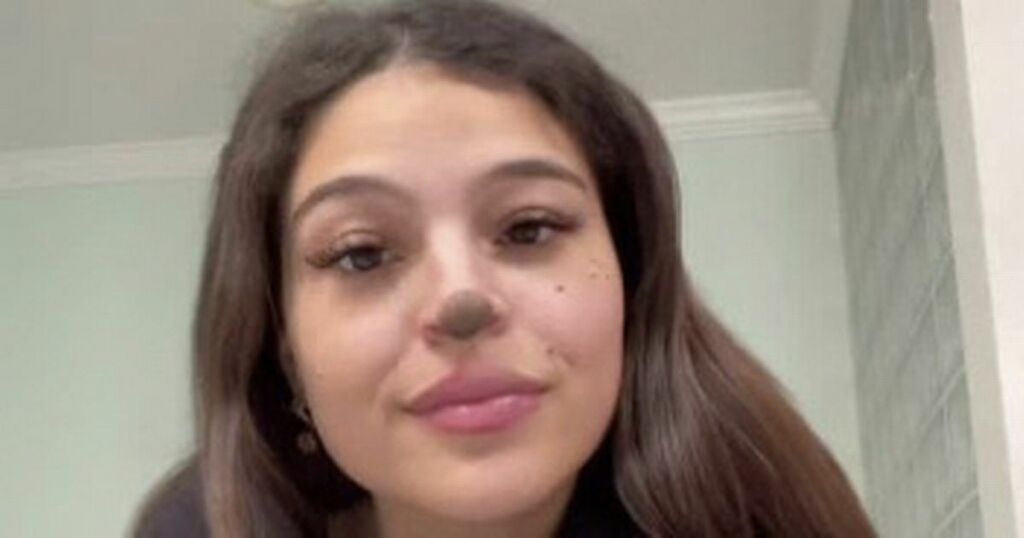 Woman relentlessly bullied for her nose birthmark hits…