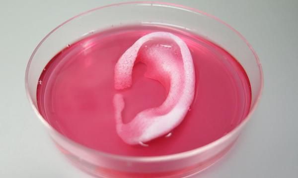 'Bioprinter' creates bespoke lab-grown body parts for…