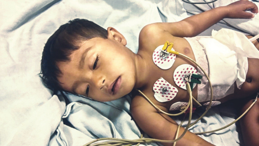 Jaipur: Doctors extract needle from kid’s liver