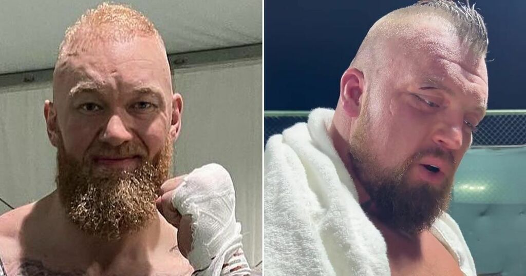 Eddie Hall cut above both eyes but Thor Bjornsson left…