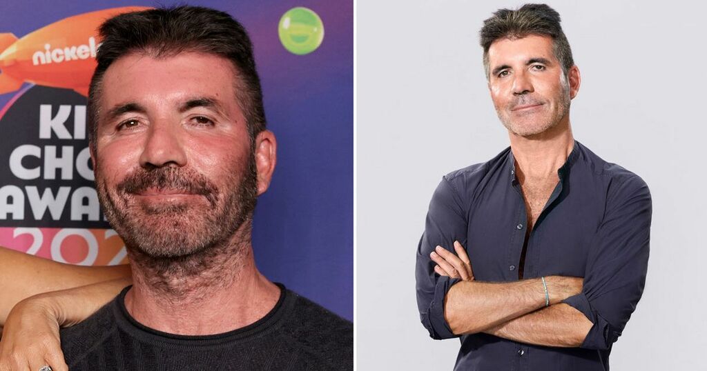 Simon Cowell's changing face after saying Botox left…
