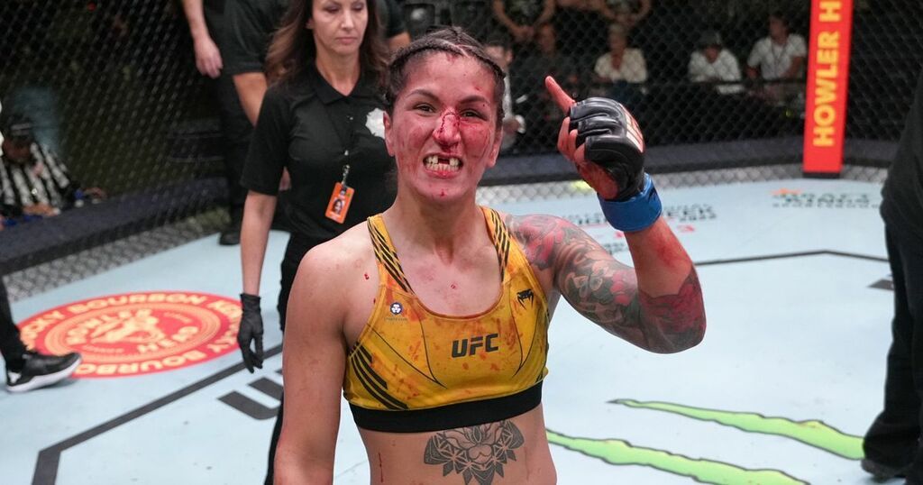 UFC star shows off missing front teeth and busted nose…