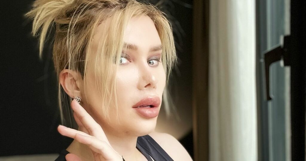 British man undergoes £230,000 plastic surgery to make…