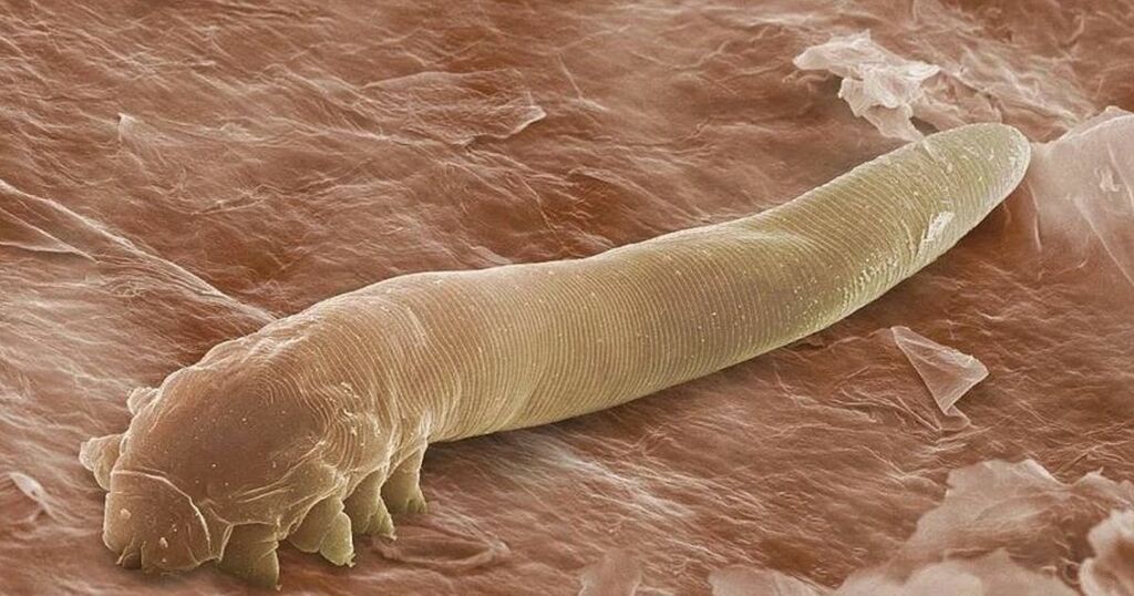 Thousands of microscopic mites live on your face - and…