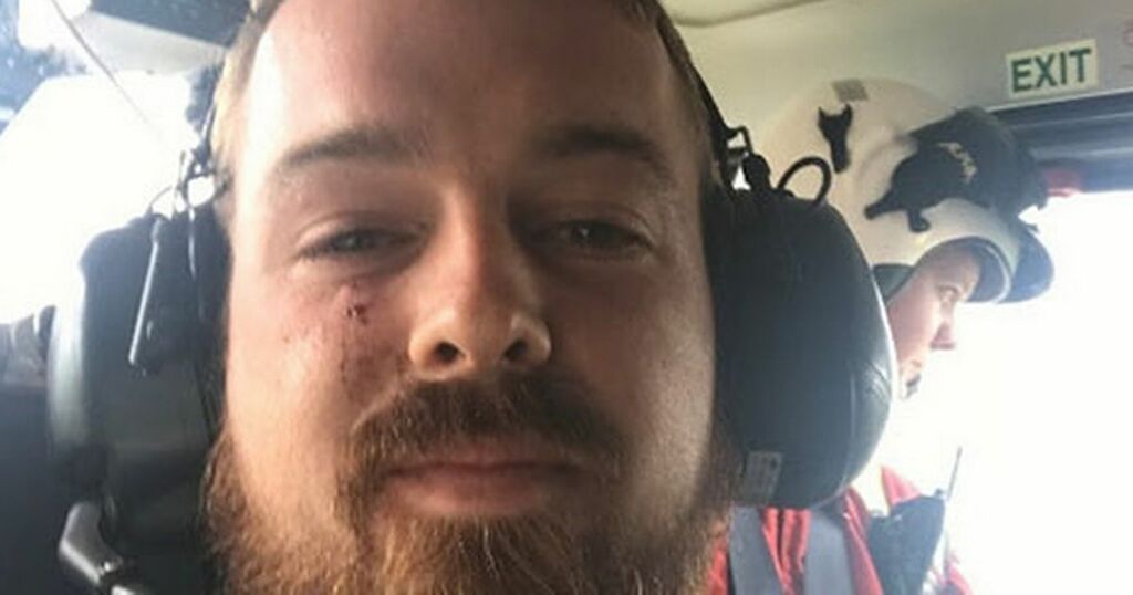 Miracle as tree surgeon survives horrific accident as…