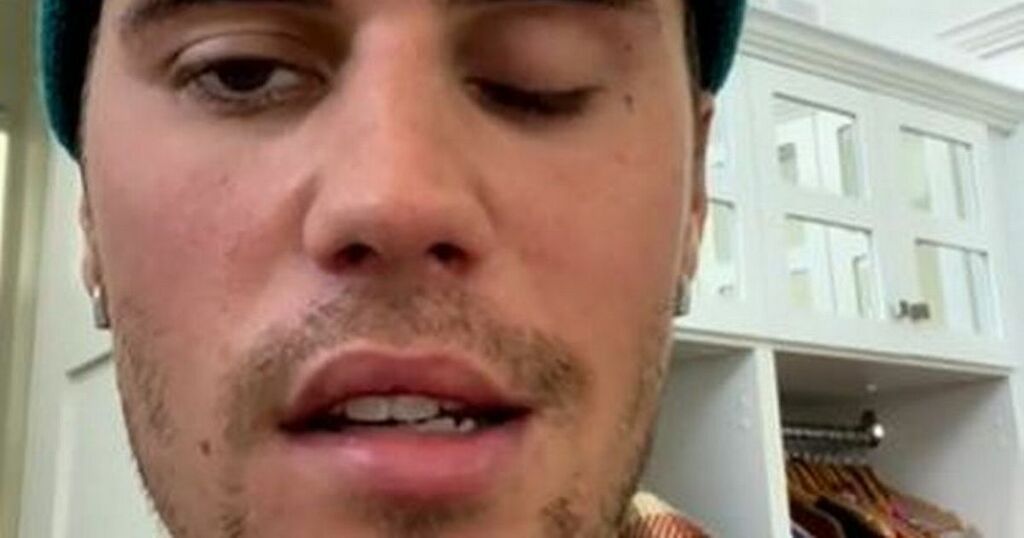 Justin Bieber's face left paralysed after being…
