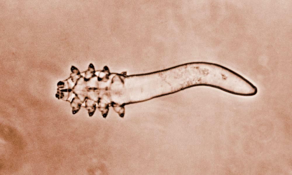 Mites that mate on our faces at night face extinction…