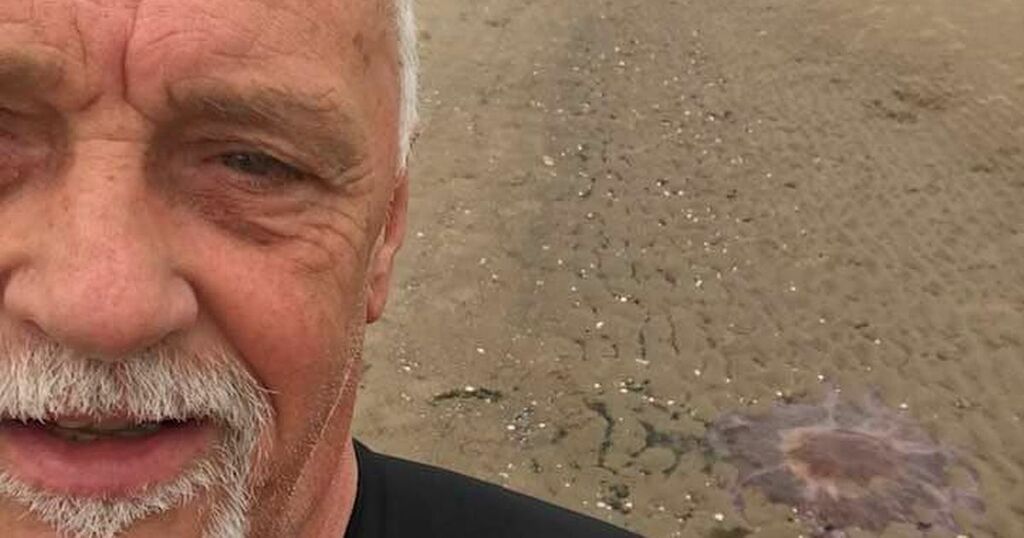 Edinburgh swimmer's warning as stinging monster…