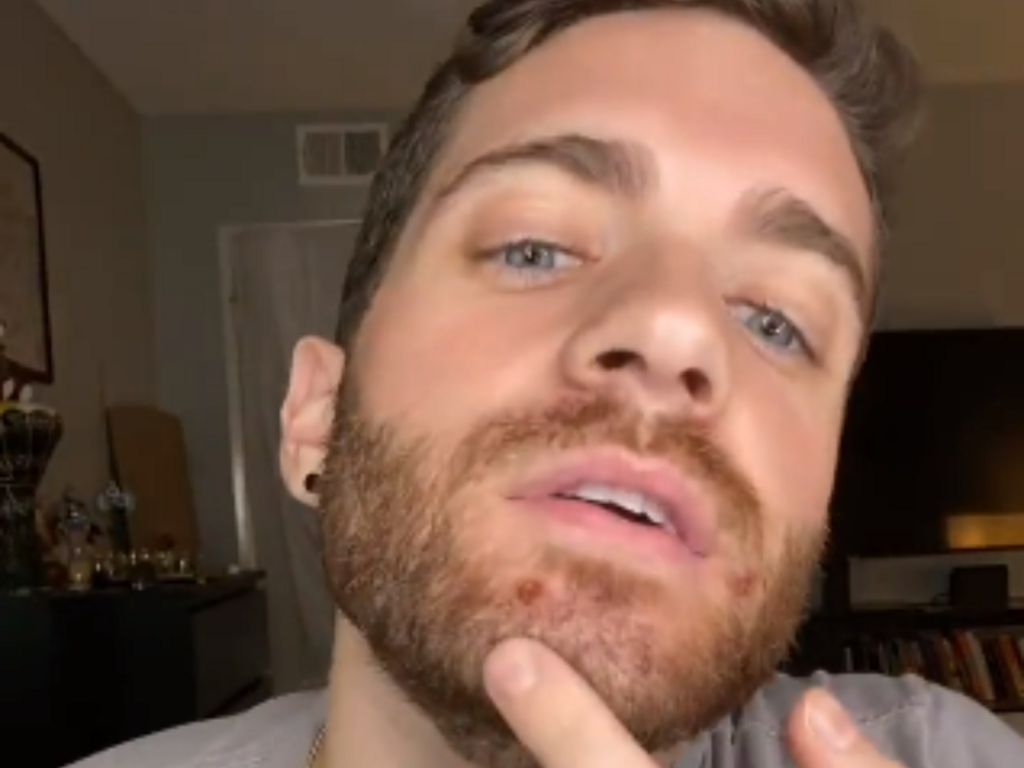 Actor Matt Ford opens up about his monkeypox…