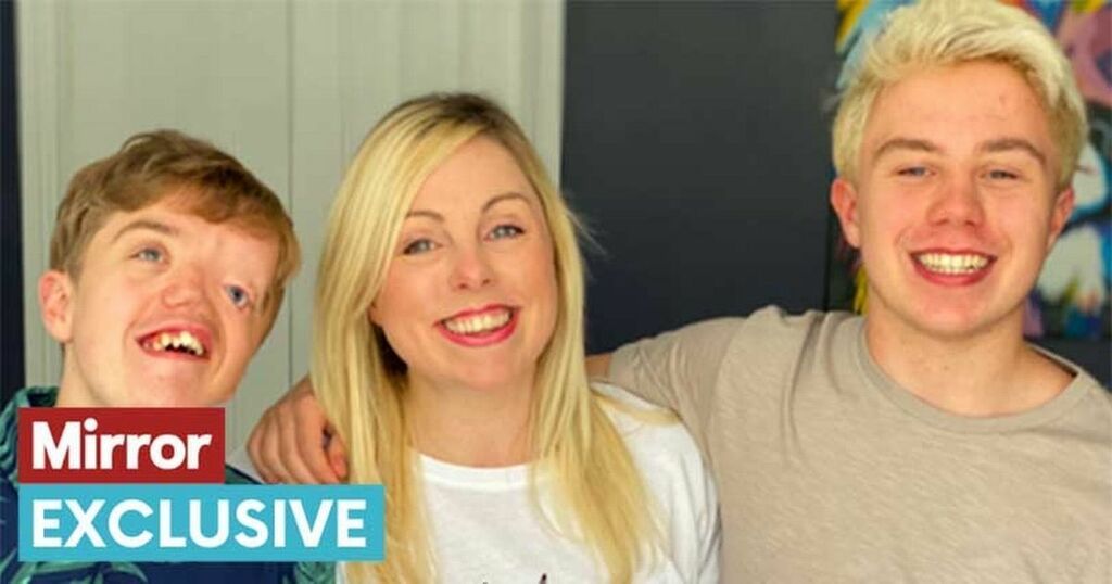 Mum of boy born with no eye socket, nostril or ear…