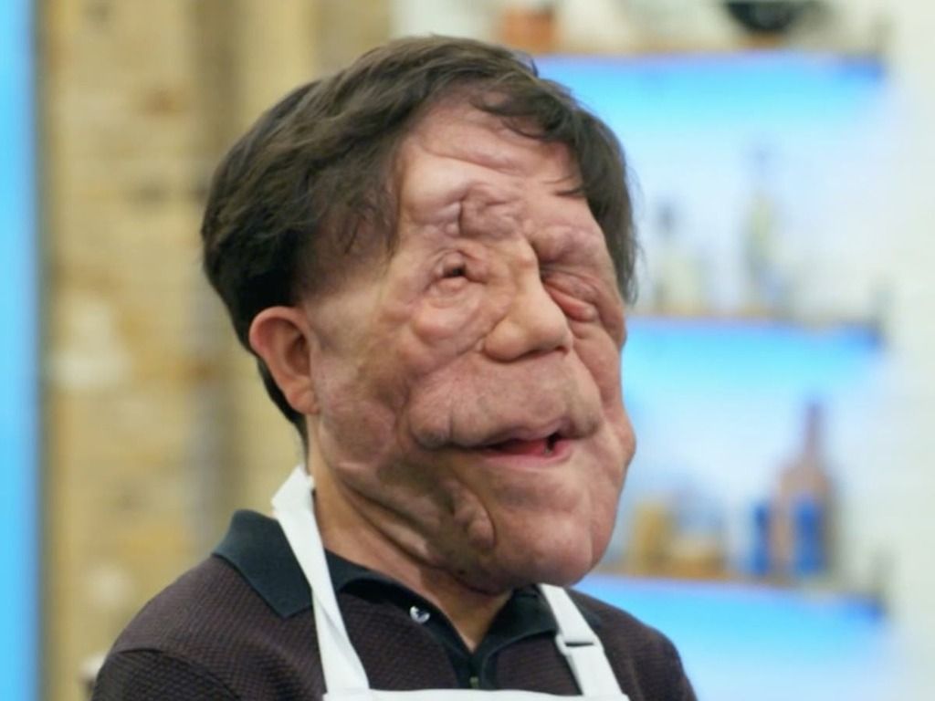 Celebrity MasterChef contestant Adam Pearson issues…