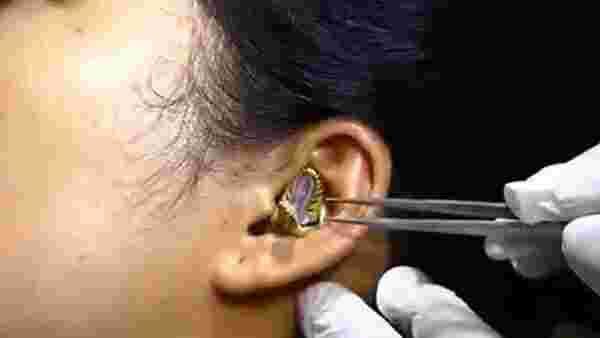 Watch: Snake in the...ear! Serpent stuck in earhole…