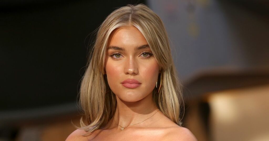 Emmerdale's Mimi Slinger's life after soap exit - from…