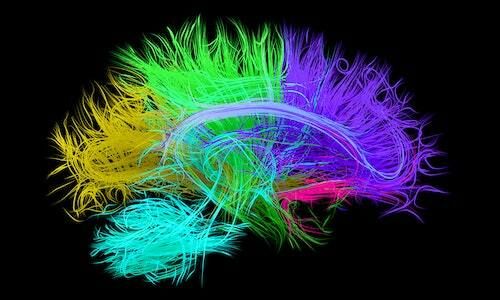 Does mindfulness change the brain? Research fractures…