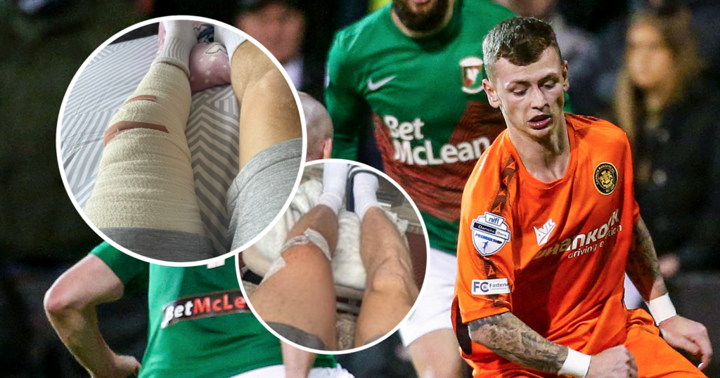 Irish League footballer details "crazy" ACL surgery…