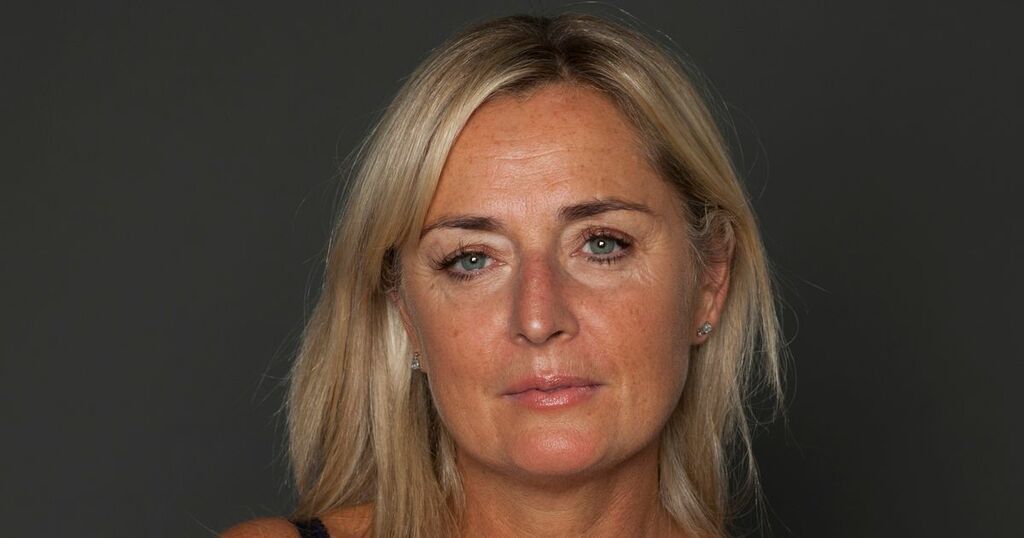 Mum of teen girl born with incurable 'Butterfly Skin'…