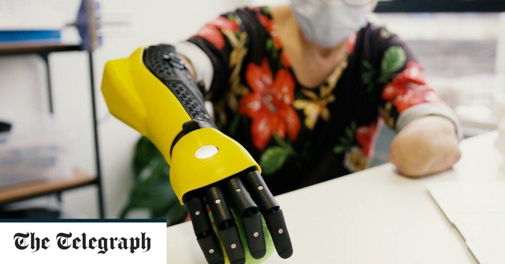 Brain-controlled bionic arms to be offered to amputees…