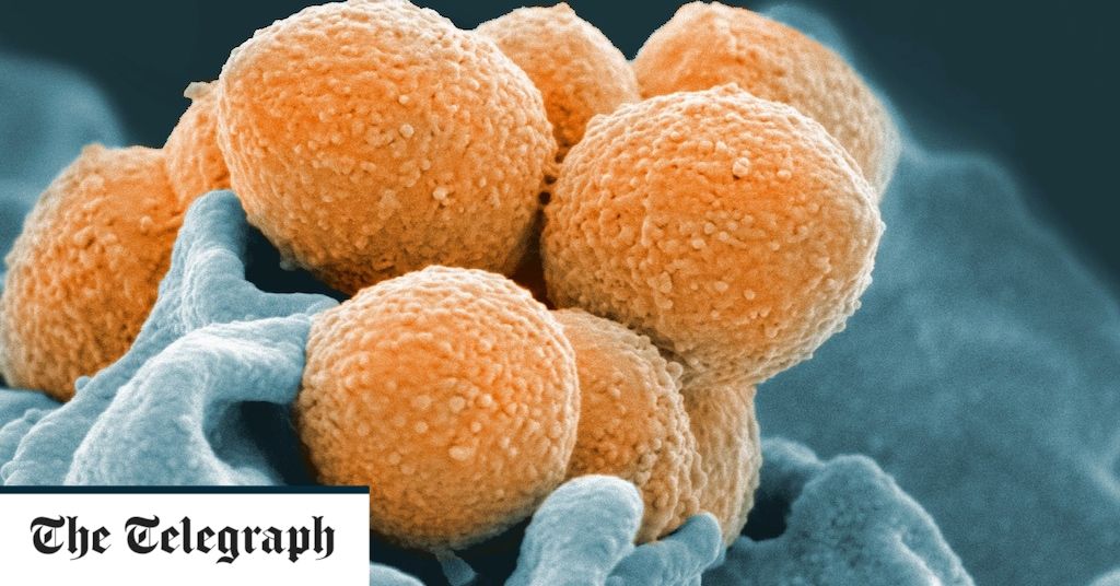 Undetectable superbug strain of Strep A discovered…