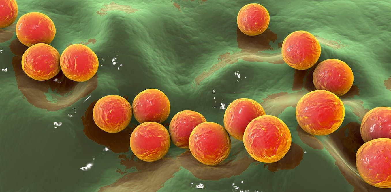 Strep A: three doctors explain what you need to look…