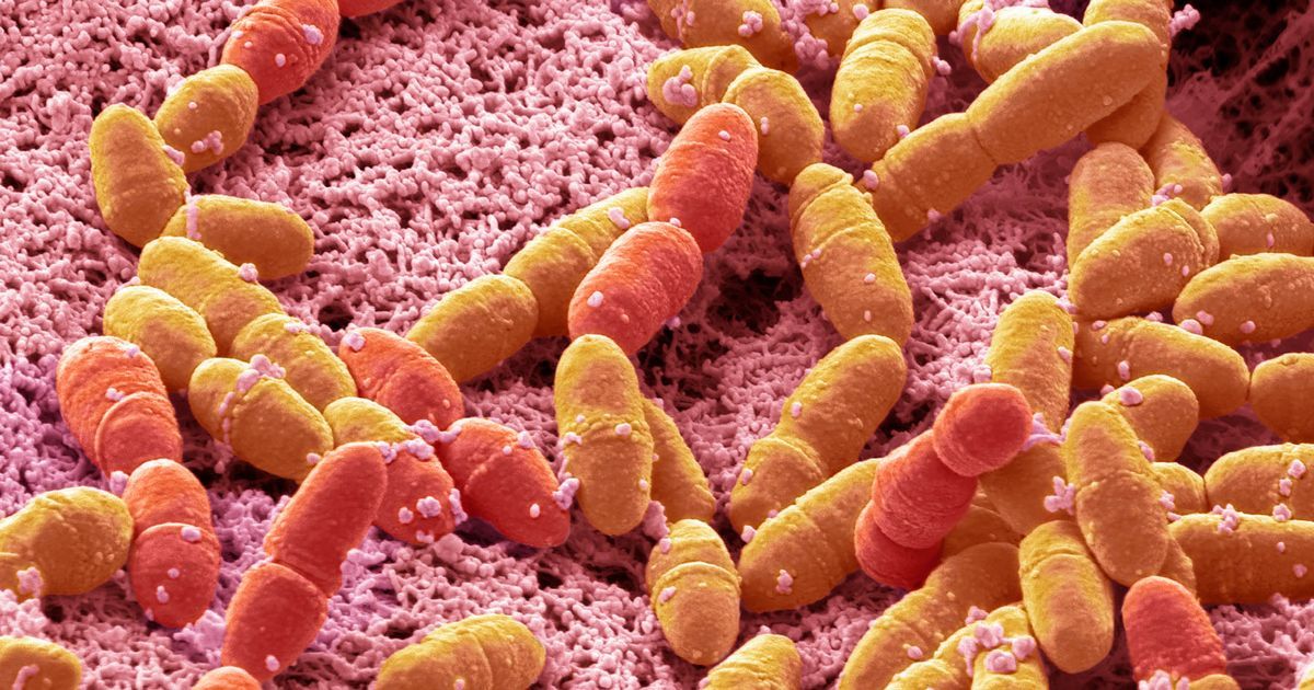 Strep A infection Ireland: What is it, top symptoms,…