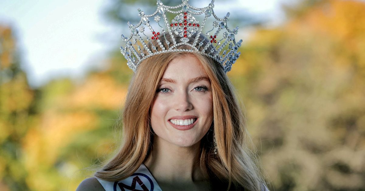 Woman bullied for being ginger becomes model with…