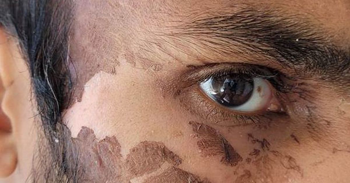 Police officer has scalding hot water thrown in his…