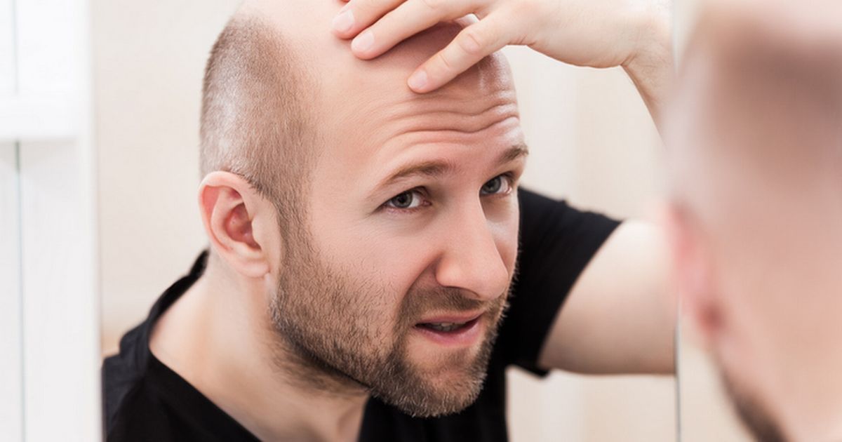 Scientists discover new 'cure for baldness' as they…