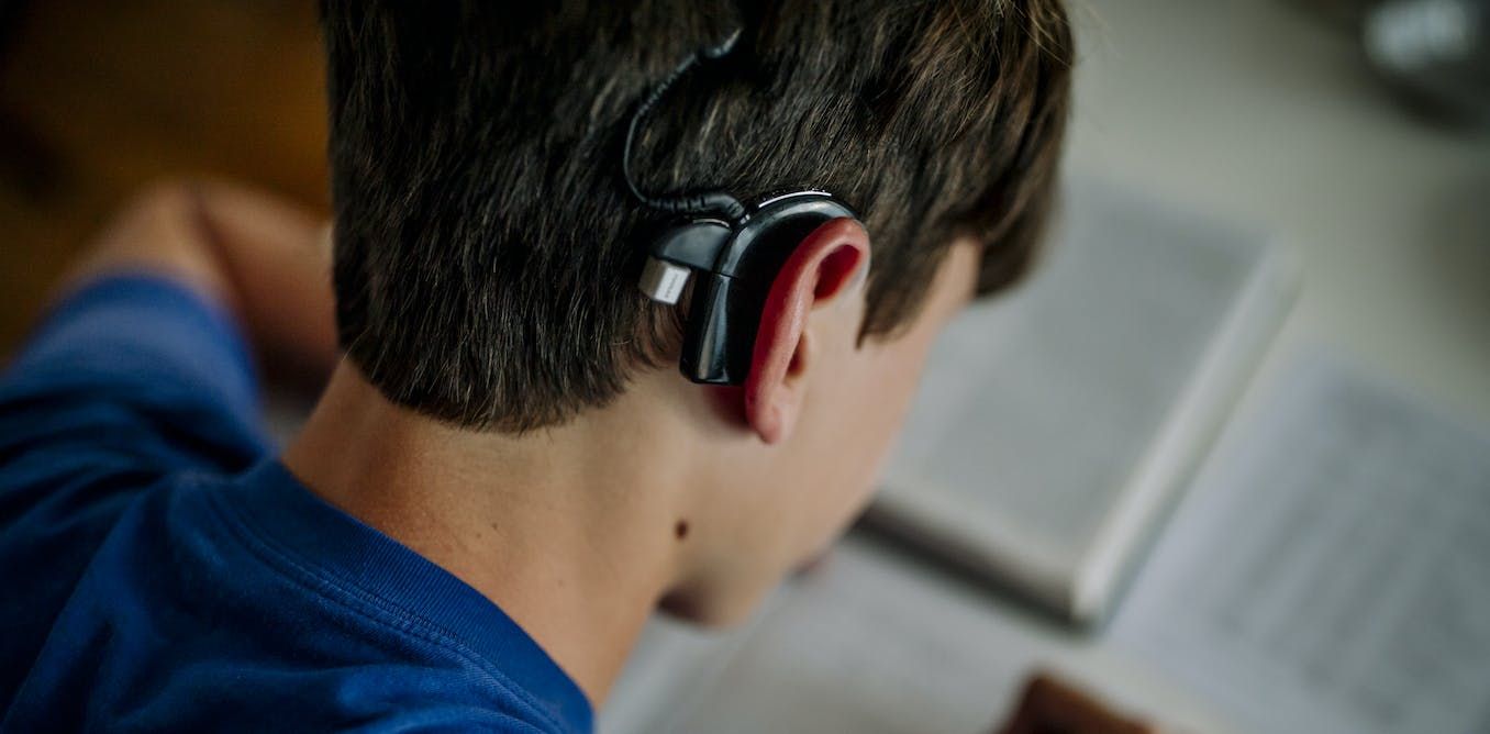 Cochlear implants can bring the experience of sound to…