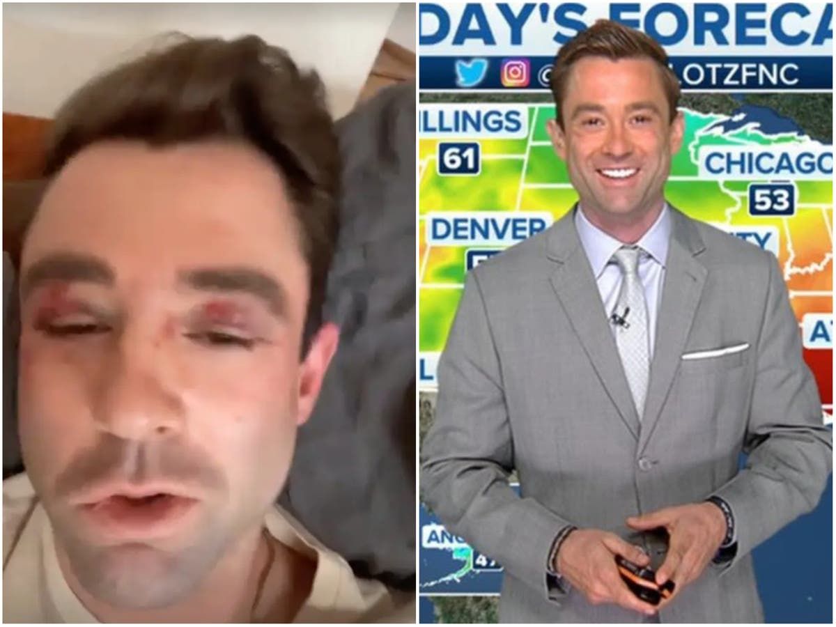 Fox News weatherman who claims he was beaten on New…