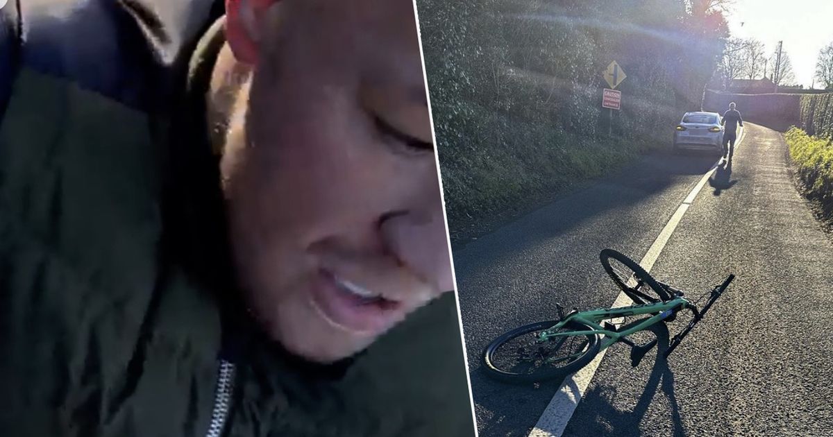 Conor McGregor shows off cut on his bum after UFC star…