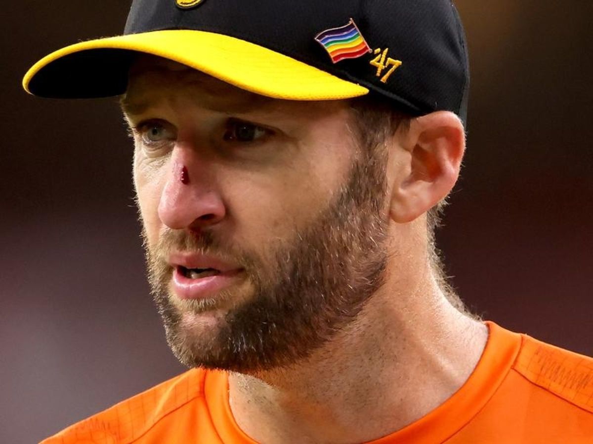 AJ Tye out to repeat BBL triumph in England's T20 Blast