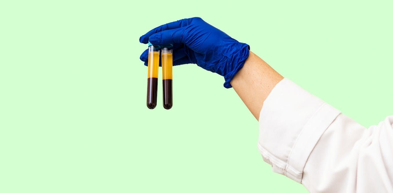 How do blood tests work? Medical laboratory scientists…