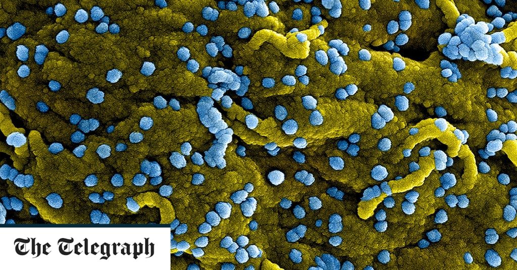 What is the deadly Marburg virus? Symptoms, causes and…