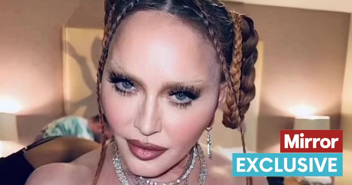 Madonna has vertical facelift and fillers to get…