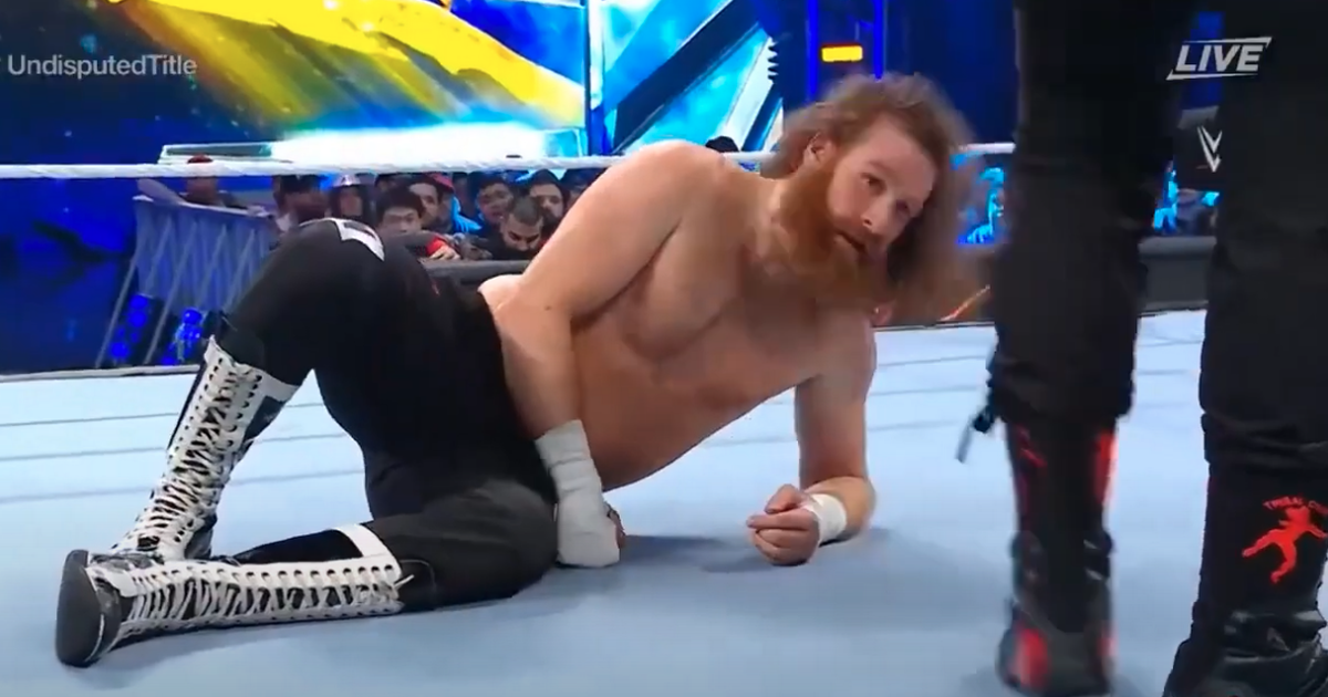 WWE star shows off gruesome injuries after epic…